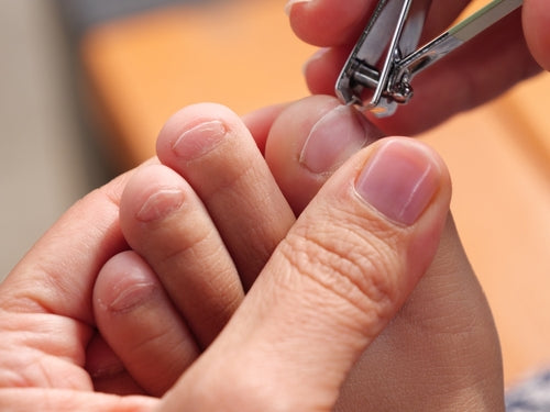 How to Cut Your Toenails the Right Way (and Avoid Painful Ingrown Nail ...