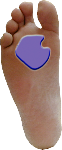 Dr. Jill's Gel Dancer's Pads – Pedicurian